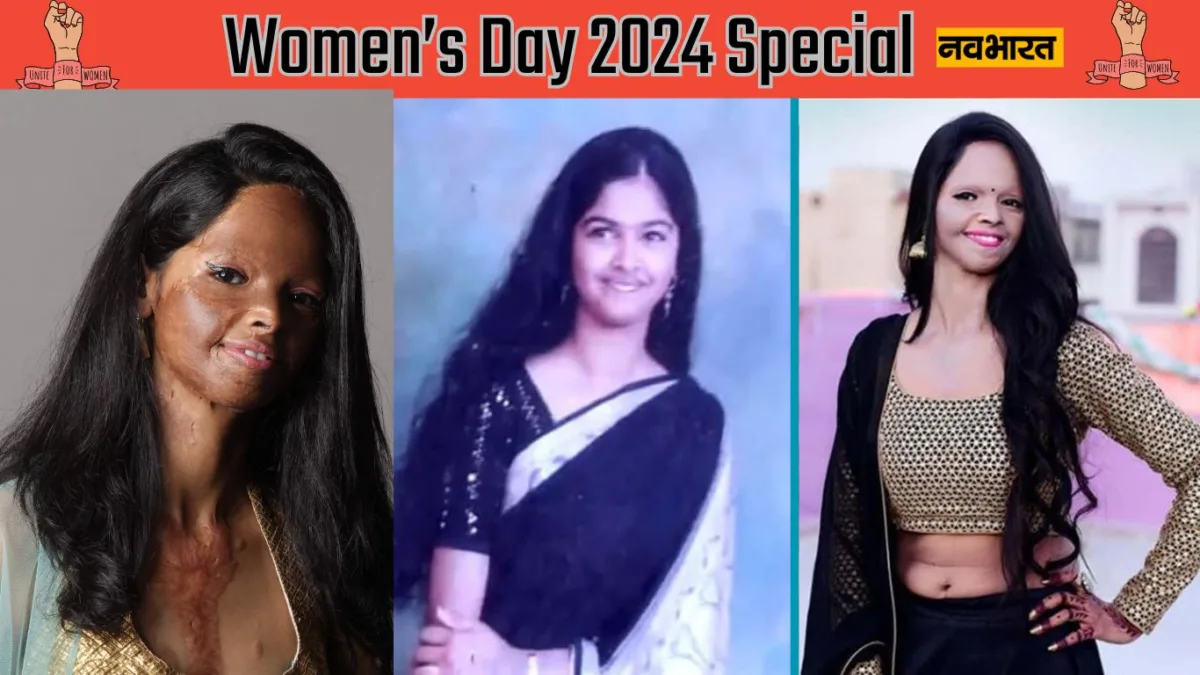 सपनों के संघर्ष की प्यारी कहानी, एसिड अटैक भी नहीं तोड़ पाया हौसला, अब पति ने भी छोड़ा साथ तो..